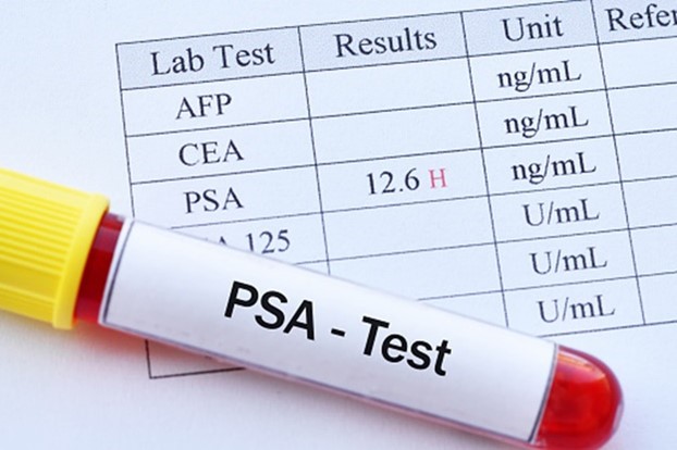 Findings from the ProtecT trial: A prostate cancer ‘good news’ story ...